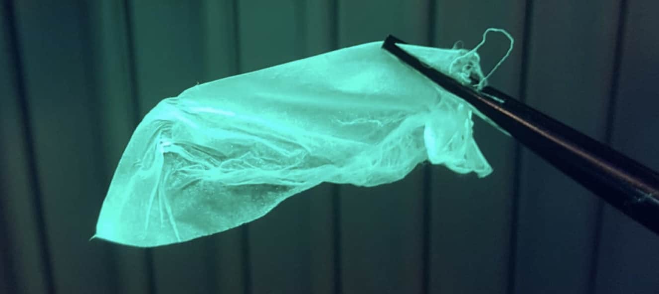 Smart wound dressings with healing sensors developed by RMIT